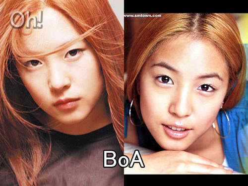 Elz Room: Before-After Plastic Surgery Korean Artist