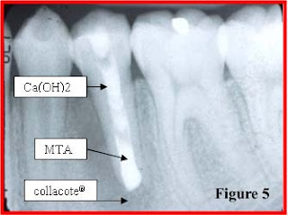 Saint Joseph's Pediatric Dentistry Lit Review: Multifaceted Use of ...