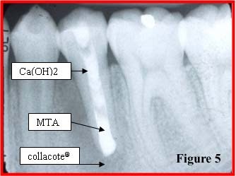 Saint Joseph's Pediatric Dentistry Lit Review: Multifaceted Use of ...