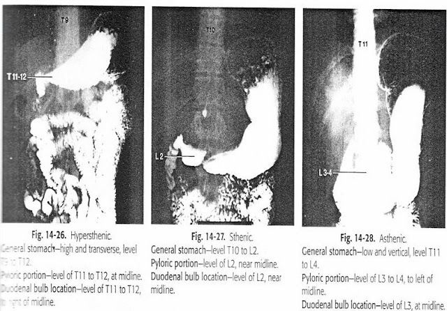 Teknik Radiografi : Oesofagus Maag Duodenum | OH MY GOD IT'S RADIOLOGY!!