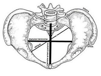 Seputar Radiologi: PELVIMETRI