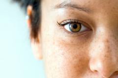 :: Em dia com a saúde ::: Quando devemos retirar uma pinta?