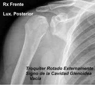 traumatologia: TRAUMATO