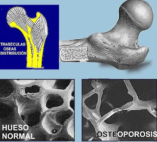 UNT PRACTICOS DE TRAUMATOLOGÍA: Lesiones traumaticas de Cadera y Pelvis
