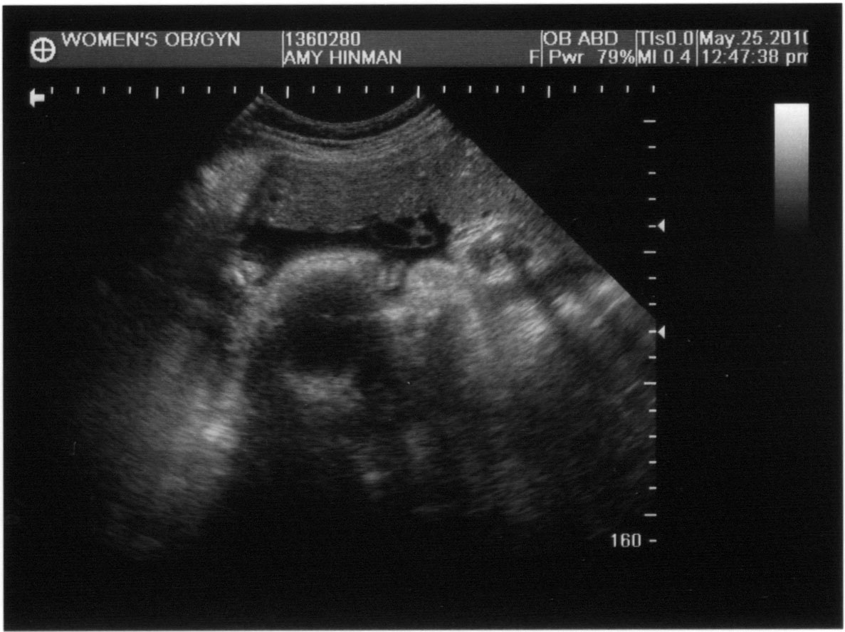 Amy's Nonsense: Pictures: Nursery and 36 week ultrasound!