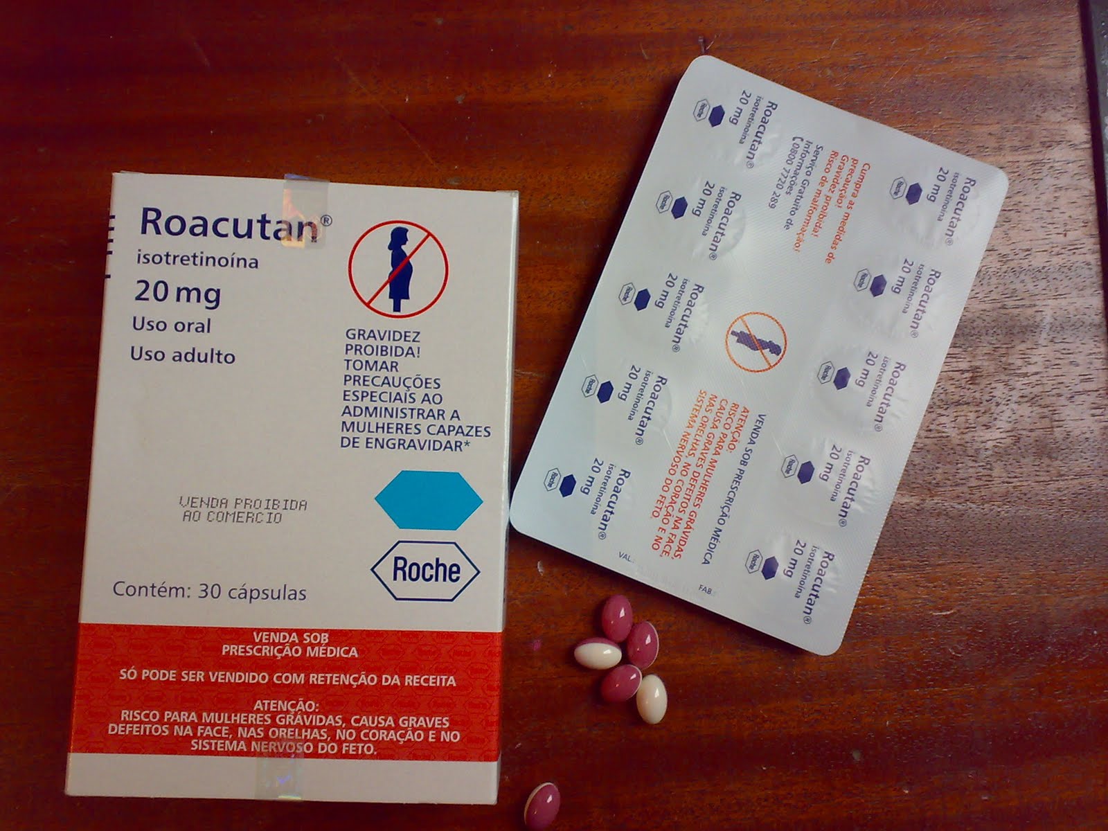 Donna Branquela: ROACUTAN: Será a solução para minha pele oleosa e com ...