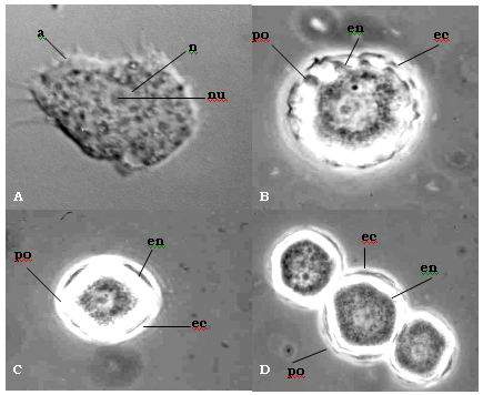 Previene Issstecali por Amiba de la Vida Libre | Dialogando con el Búfalo