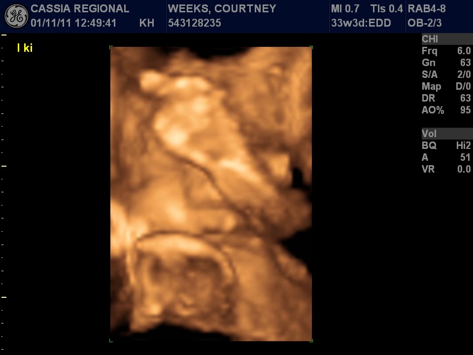 Jason and Courtney: Riley's 33 week ultrasound