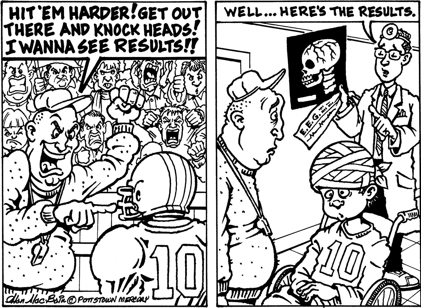 Sport Concussion Cartoons | Bruising The Melon