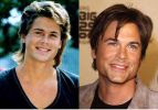 does rob lowe's plastic surgery look good?
