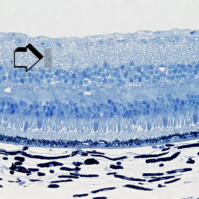 jeremy's stuff: Eye (histology slides)