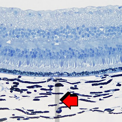 jeremy's stuff: Eye (histology slides)