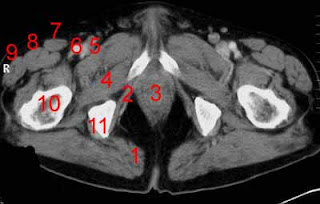 RadiologySpirit: HOW TO READ CT ABDOMEN