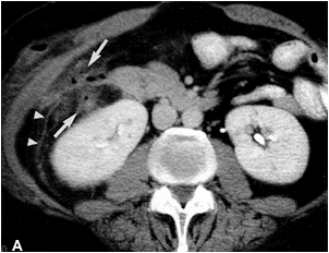 RadiologySpirit: 2010-04-25
