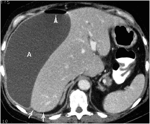 RadiologySpirit: 2010-04-25