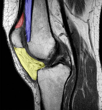 RadiologySpirit: 2010-05-23