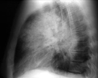 RadiologySpirit: 2009-10-11