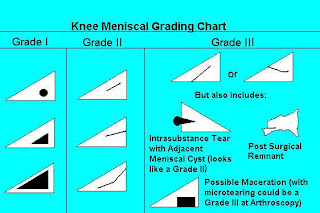 RadiologySpirit: Meniscal Tears