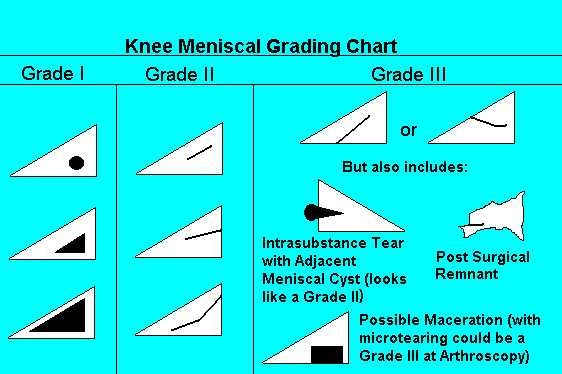 RadiologySpirit: Meniscal Tears