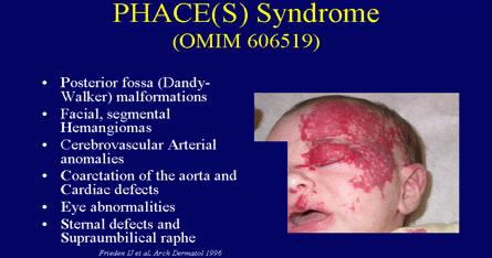 RadiologySpirit: PHACES Syndrome