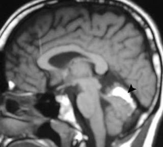 RadiologySpirit: October 2009