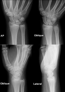 RadiologySpirit: Normal Hand and Wrist Anatomy