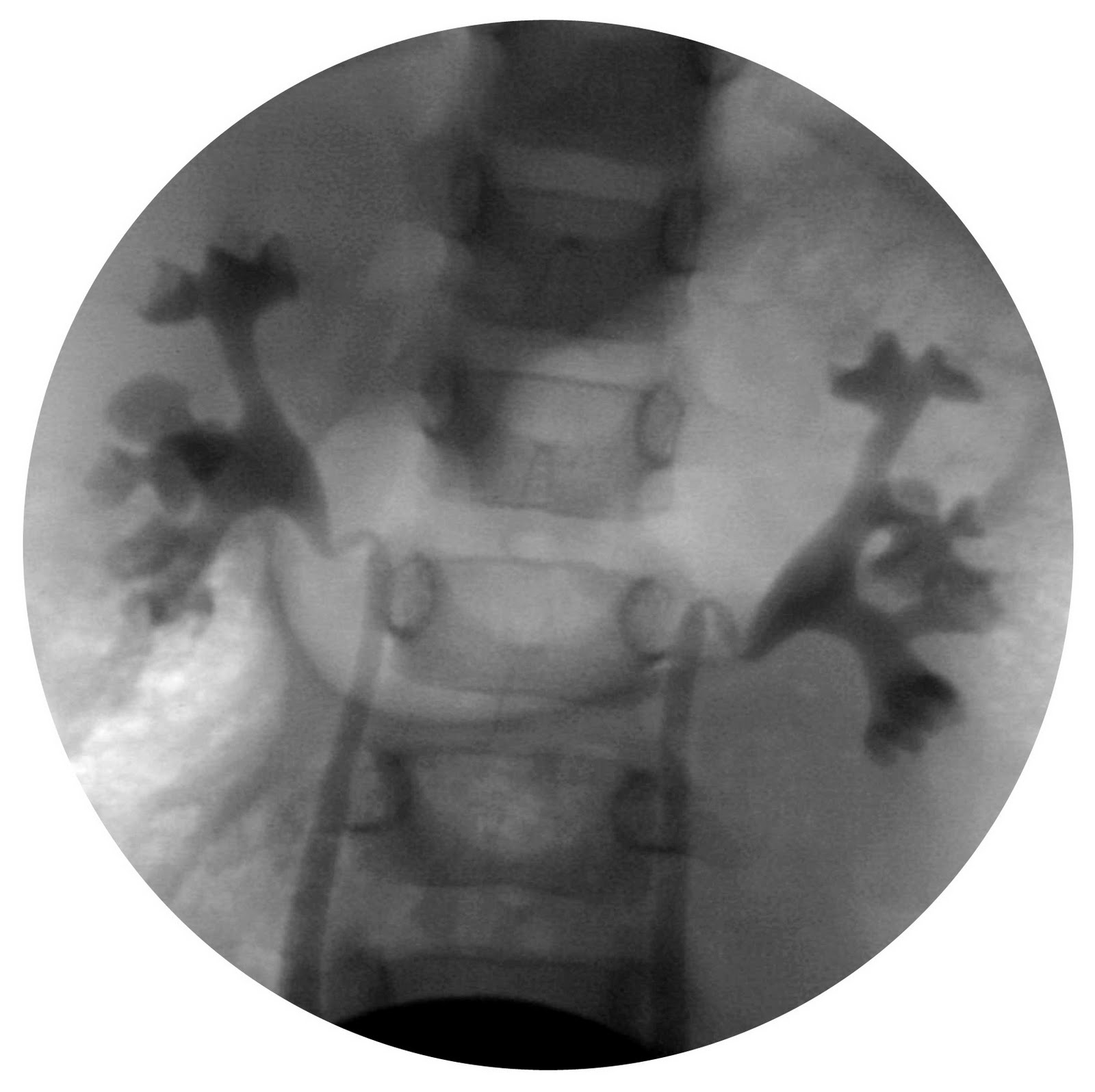 RadiologySpirit: 2010-07-04