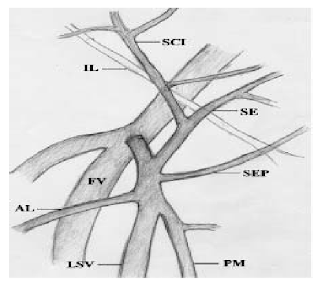 RadiologySpirit: surgical anatomy of saphenous veins