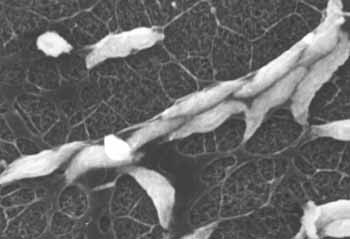 Skeptic Wonder: Sunday Protist - Labyrinthulomycota