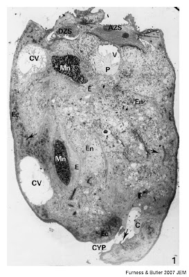 Skeptic Wonder: Sunday Protist - Litostomatea: rumen ciliates with ...