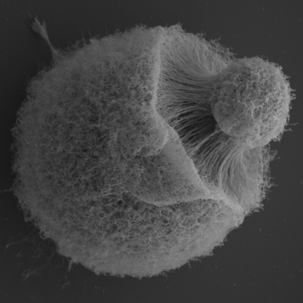 Cryptococcus neoformans, microscopía de barrido electrónico ~ Edición Salud