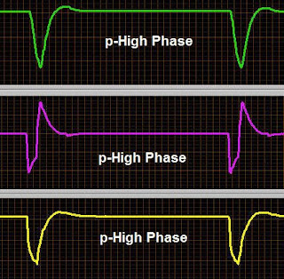 FREMITUS: What is p-High?