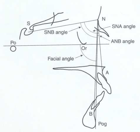 Panduan Analsis Sefalometri | Jurnal Kesehatan Lingkungan