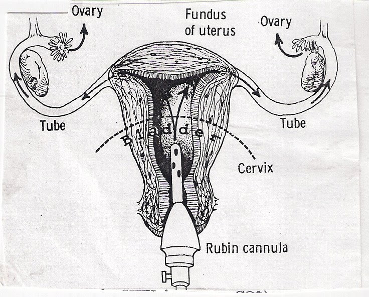 POPULAR HEALTH AND FAMILY PLANNING: COUPLES EXAMINATION AND DIAGNOSIS