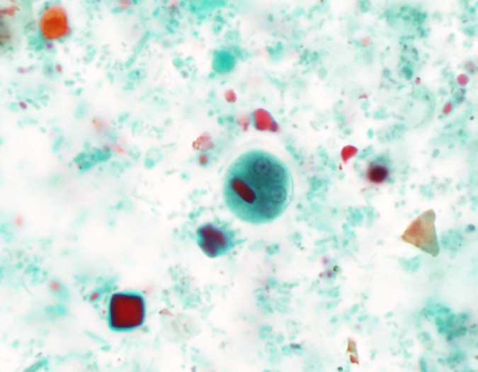 Stool Ova And Parasite