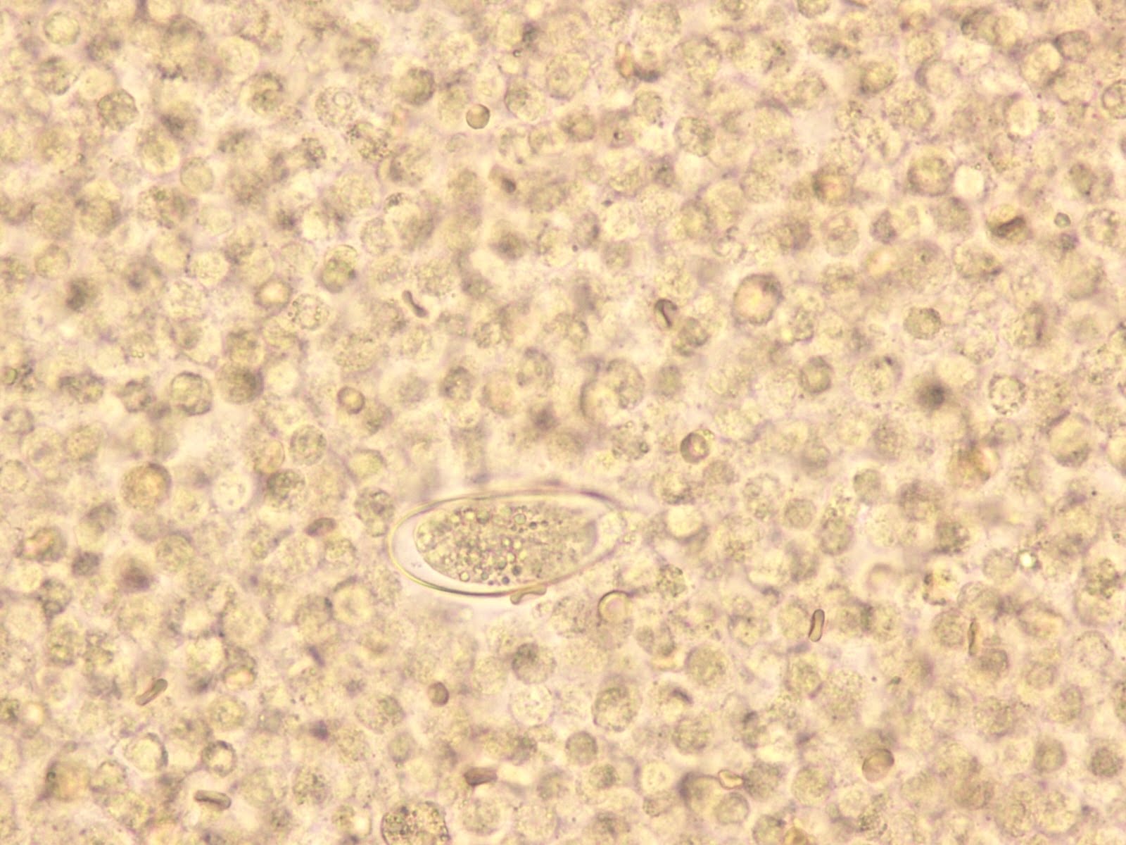 Creepy Dreadful Wonderful Parasites: Case 149