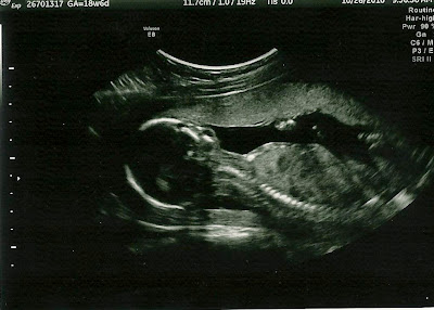 crib rock: 19 week ultrasound