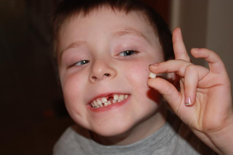 Just Us!: Lost Teeth? Anyone seen them....