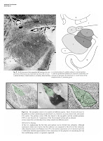 Trabajos de Investigación: EL COMPLEJO NUCLEAR AMIGDALINO: terminología ...
