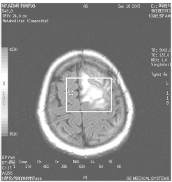 Radiologi: Magnetic Resonance Imaging (MRI)