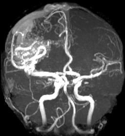 Radiologi: Magnetic Resonance Imaging (MRI)