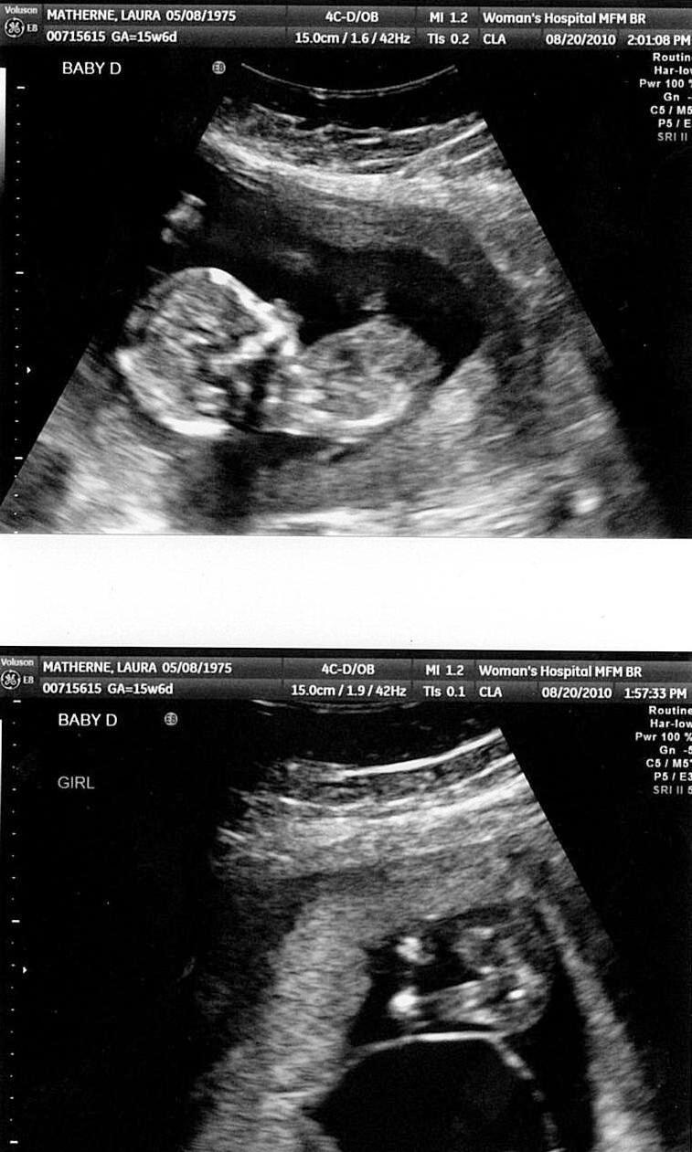 The Matherne Quads!: Pics from 16 week ultrasound - Baby D- Its a Girl!