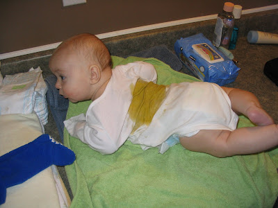 Trials And Tribulations: World's Most Disgusting Baby