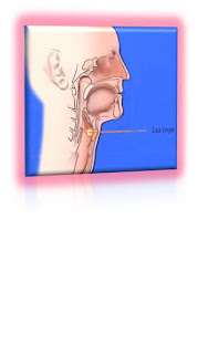 laringitis agudas y cronica