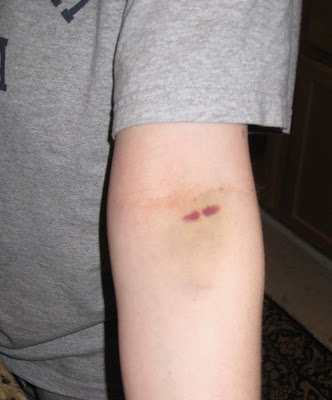 Where Did I Get This Lemon?: When Blood Draws Go Bad...