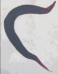 ECOLOGIA: Zoologia - Aulas de Biologia -Asquelmintos, Anelideos ...