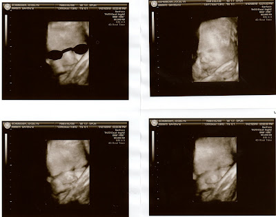 Nyla Isabella Schmieder: 35 week Ultrasound