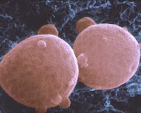 RachelYScientist2: Archaebacteria - Halobacterium salinarum