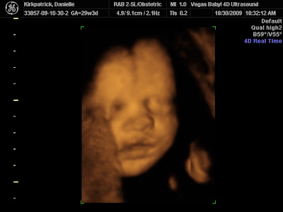 Three Kids and a House: 31 weeks 4D Ultrasound photos