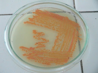 .::Microbiologia::.: Serratia marcescens em placa com Agar Mueller ...